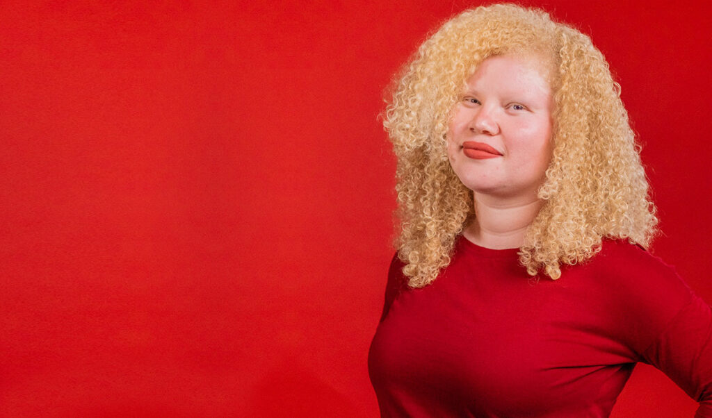 “A gente quer ver pessoas com deficiência além da cota”